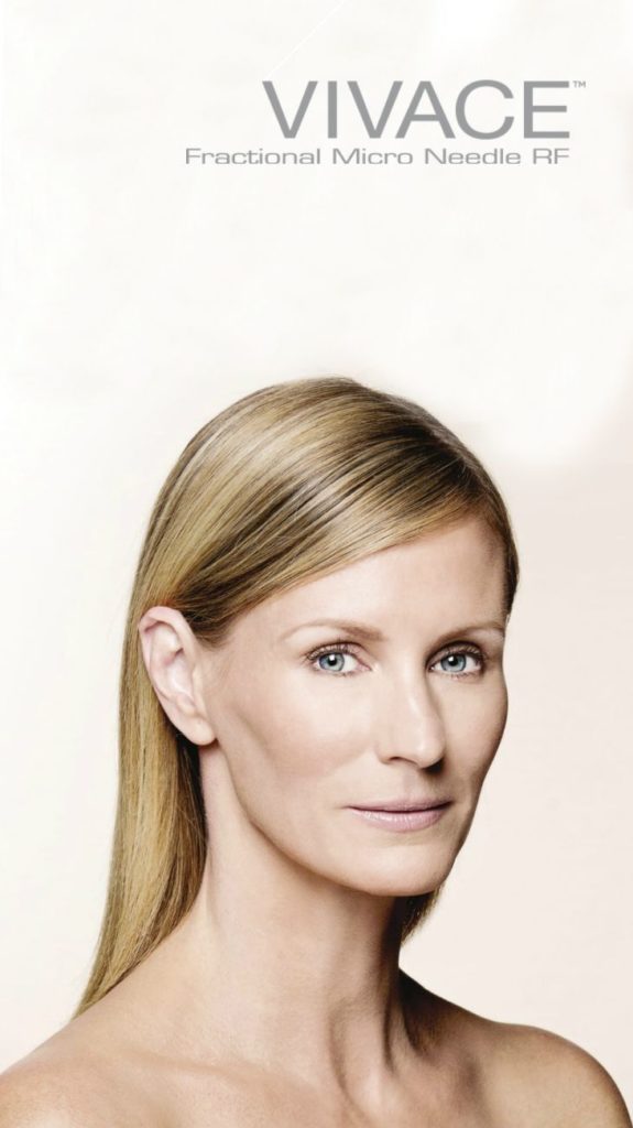 Vivace RF | Microneedling | Skin Rejuvenation | The Menkes Clinic